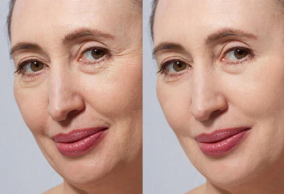 True Skinly - Rejuvenate & Transform Your Neck in Just 4 Weeks